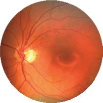 Nova Eyecare - Vision & Dry Eye Center in Anchorage, AK