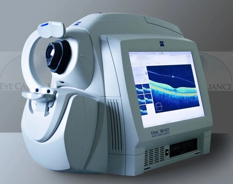 Specialty Diagnotic Eye Test - Nova Eyecare